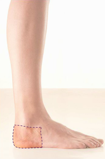 Sagital Right Heel Highlighted - Family Podiatry Center